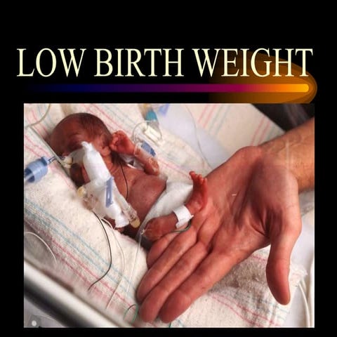 Low Birth Weight LBW - Presented By Mohammed Haroon Rashid | PPTX