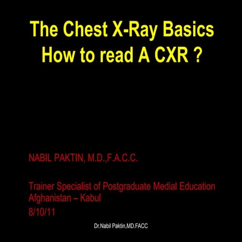 Chest-X ray , How to read a CXR | PPSX