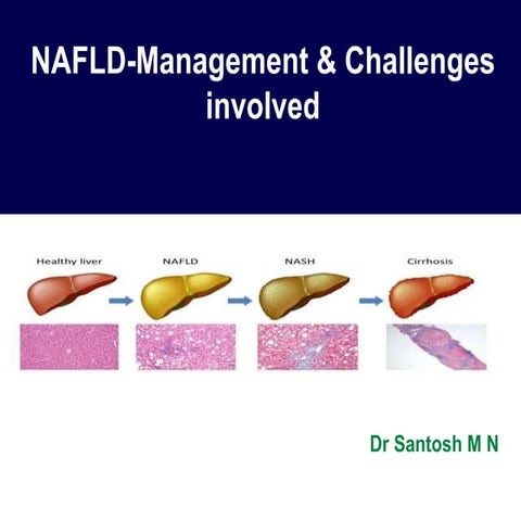 Nafld management -_challenges_involved | PPTX