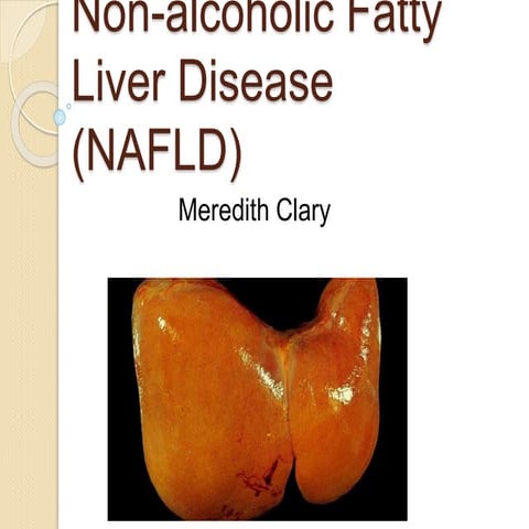 NAFLD | PPTX