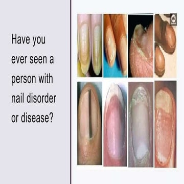 nail diseases in different people...pptx