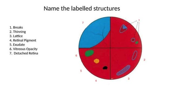 Name the labelled structures - Location of the Cranial Nerves in the ...