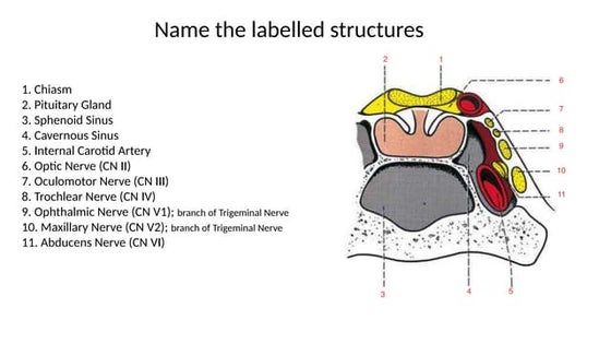 Name the labelled structures - Orbital Apex structures.pptx