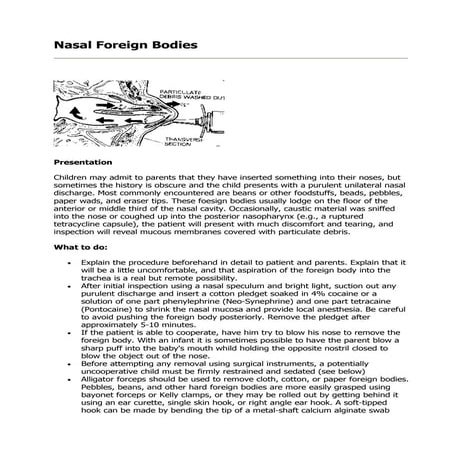 Nasal Foreign Bodies | DOC
