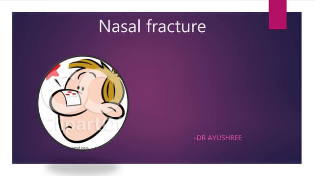 Nasal Bone Fracture Pptx