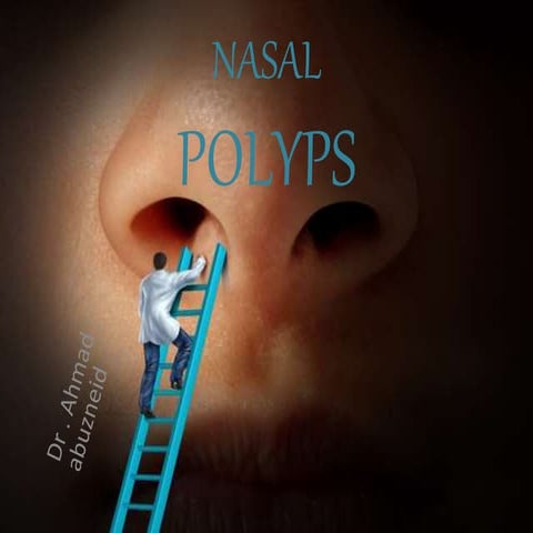 nasal polyp abu zneid.pptx | Ear, Nose and Throat Conditions | Diseases ...
