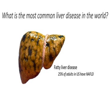 fatty liver grades.pdf