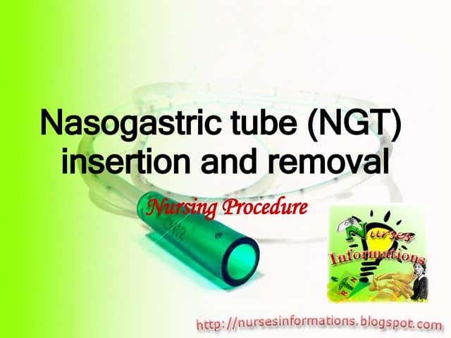Nasogastric tube feeding | PPTX