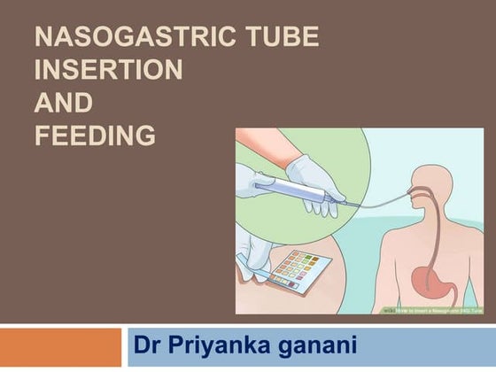 Nasogastric tube feeding | PPTX