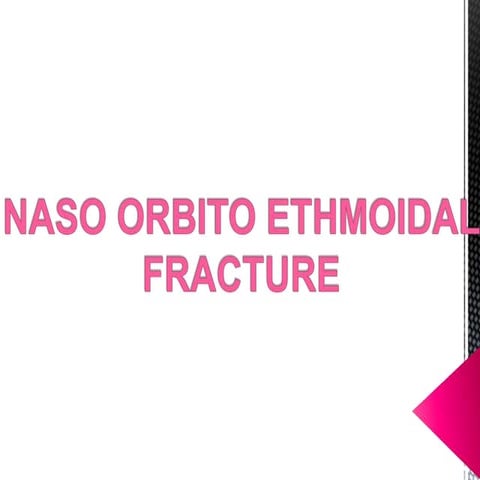NOE FRACTURE PPT | PPTX