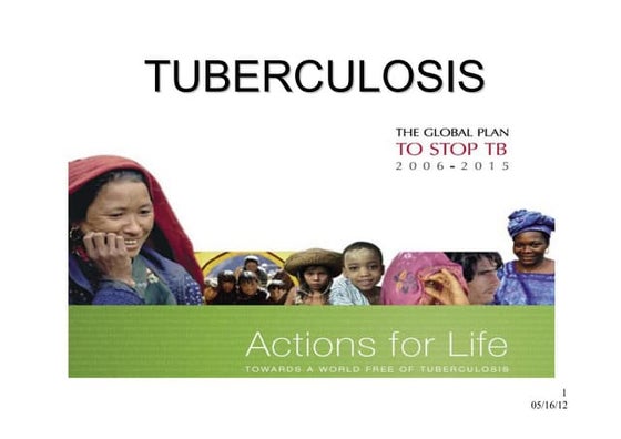 Management of TB and the different clinical guidelines | PPT