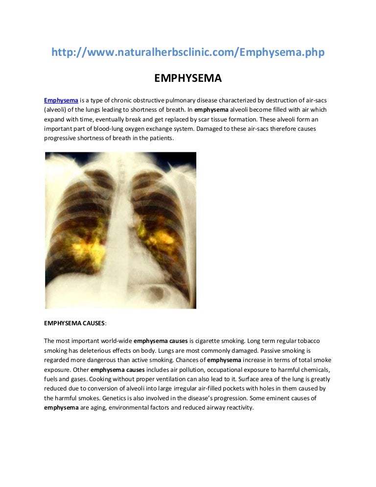Emphysema Causes, Symptoms, Diagnosis, Treatment