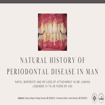 Natural history of periodontal disease in man.pdf