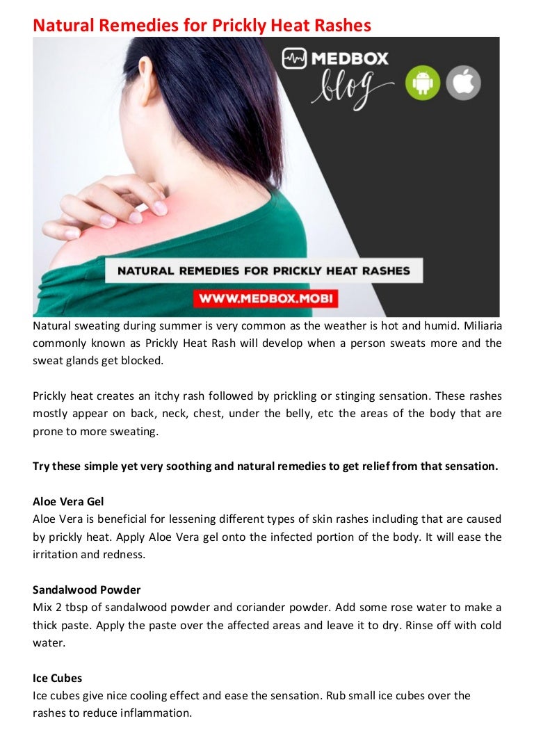 Natural Remedies For Prickly Heat Rashes