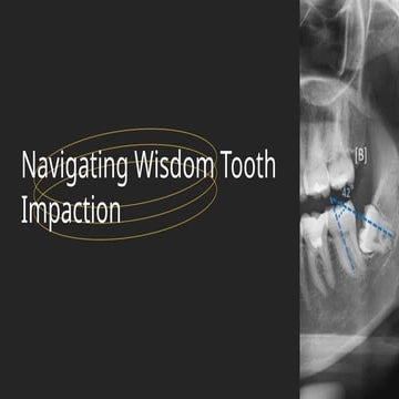 Navigating Wisdom Tooth Impaction.pptx dan | PPT