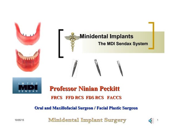Sinus lift and its alternatives-pterygoid implants and basal implants | PPT