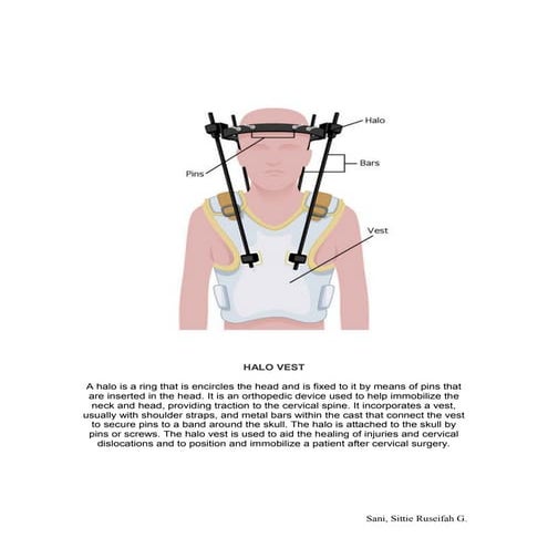 Traction - Sittie | PDF