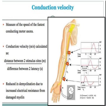 Ncv formula | PPT