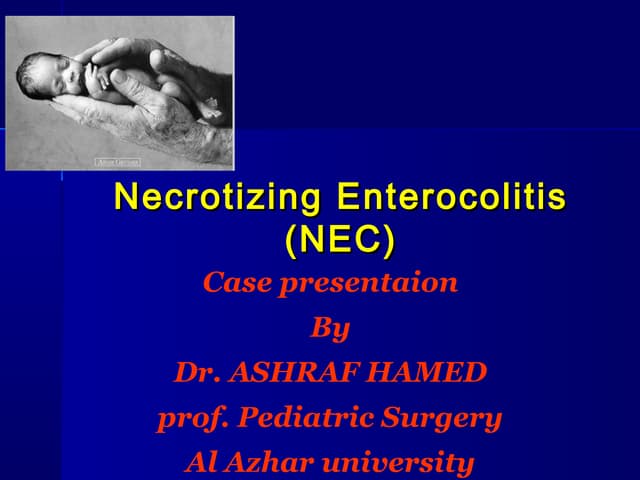Necrotizing enterocolitis | PPT