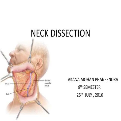 Neck dissection | PPTX