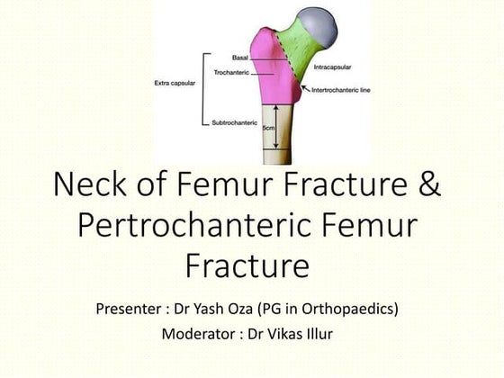 Humerus_fractures_management_and_outcomes.ppt