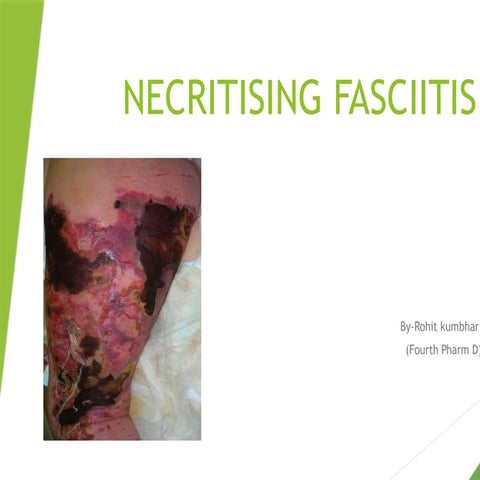 NECRITISING FASCIITIS Case presentation .pptx