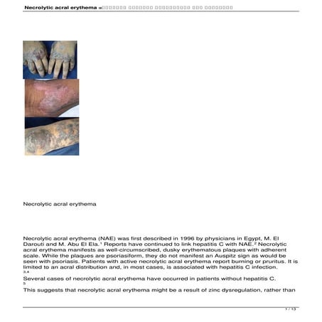 Necrolytic acral-erythema- | PDF