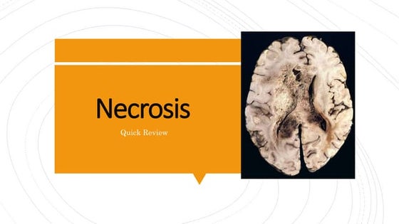 Necrosis and types | PPT