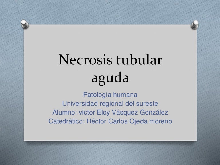 Necrosis tubular aguda