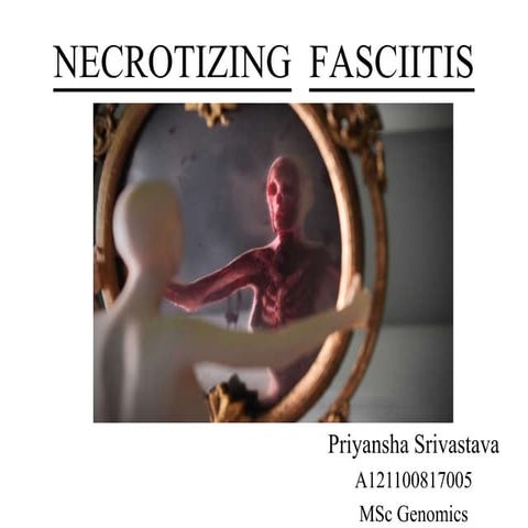 Necrotizing Fasciitis Definition Necrotizing Fasciitis (flesh Eating