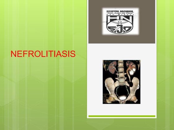 International Due Diligence | PPT