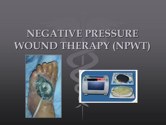 Negative pressure wound therapy(vac) | PPT