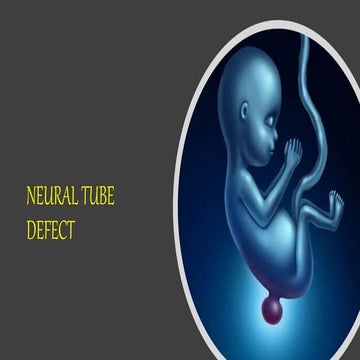 Neural Tube Defectpptx