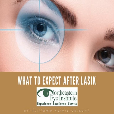 Your Guide to LASIK | PDF