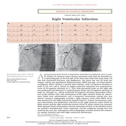 Right Ventricular Infarction | PDF