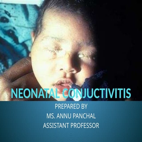 Ophthalmia Neonatorum or Neonatal Conjunctivitis | PPTX