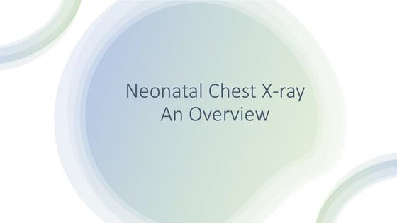 PNEUMOTHORAX IN CHEST XRAY INTERPRETATIONpptx | PPTX