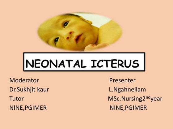 Neonatal jaundice Overview and management | PPT