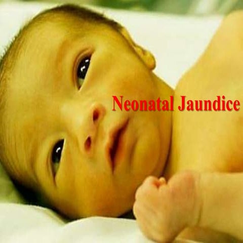 Neonatal jaundice presentation | PPTX