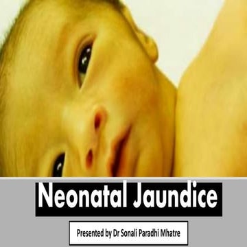 neonatal_jaundice_NICE_threshold_graphs (7).pdf