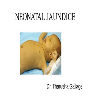 Neonatal Jaundice presentation for paediatric doctors pptx | PPTX