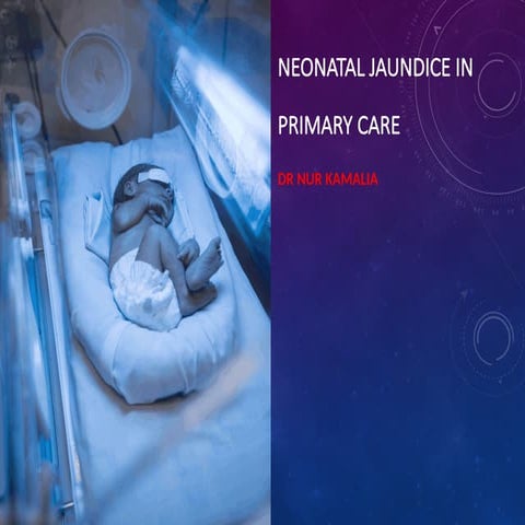 management of NEONATAL JAUNDICE in primary care.ppt
