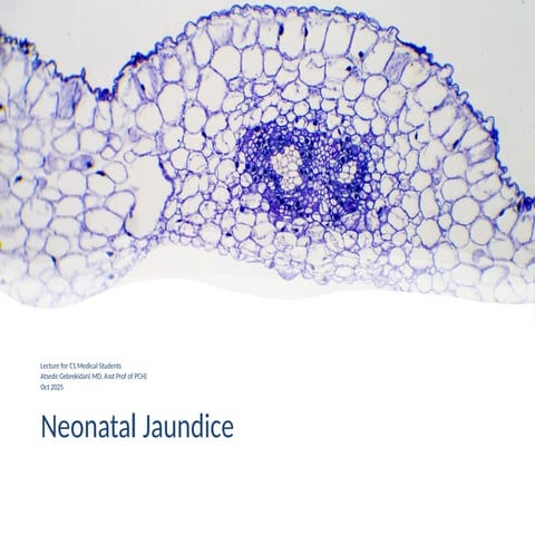 Neonatal Sepsis definition,risk factors and management | PPTX