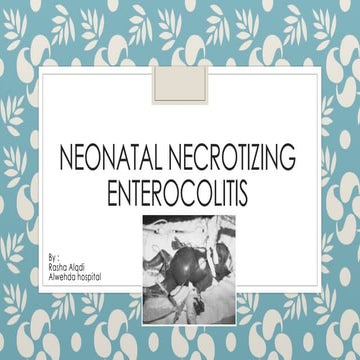 Neonatal necrotizing enterocolitis | PPTX