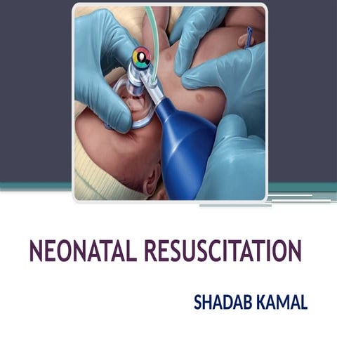 Neonatal resuscitation | PPTX