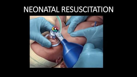Neonatal resuscitation | PPT