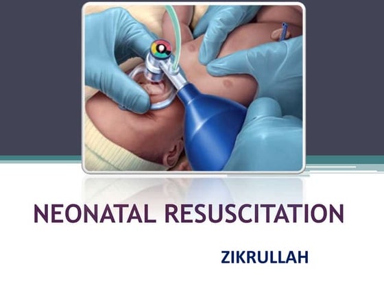 neonatal resuscitation also known as new born resuscitation | PPTX
