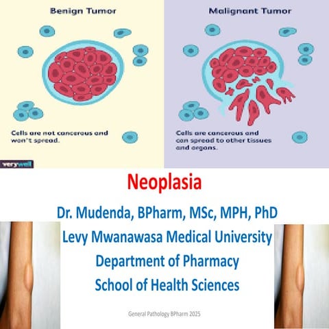 Pathology Neoplasia BPharm 2025.pdf notes | PPT