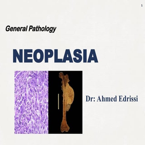 General pathology the growth and neoplasia | PPT
