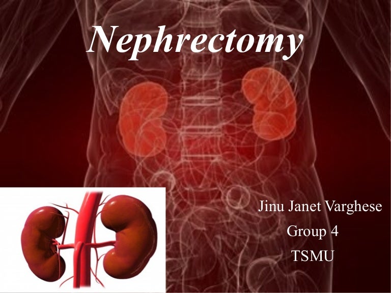 Padua Score Partial Nephrectomy Surgery